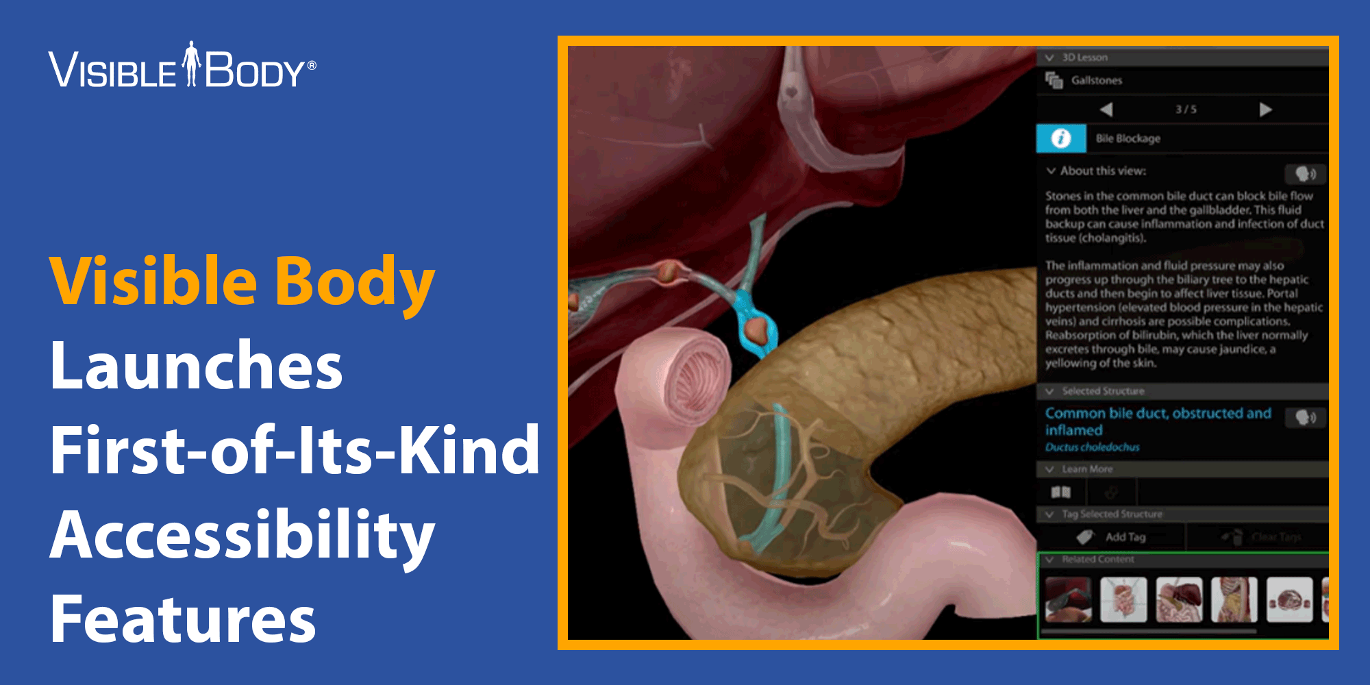 Visible Body now offers the most accessible 3D learning products on the market